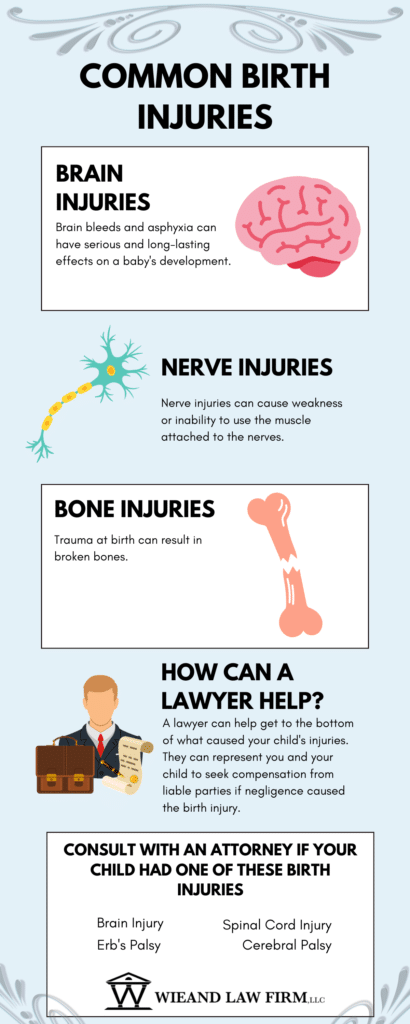 What Are Considered Birth Injuries? - Wieand Law Firm